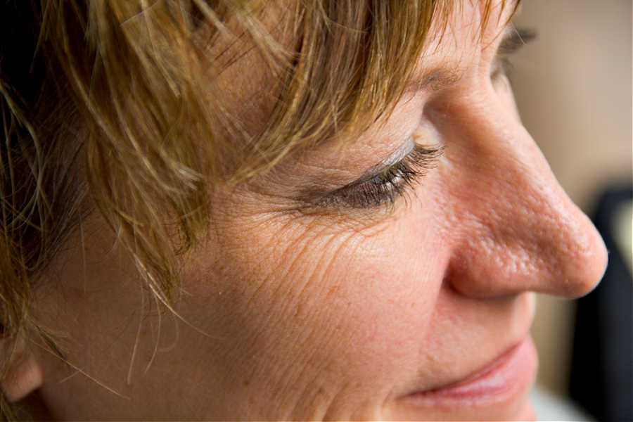 Repair First Indicators of Ageing Face. - Doctor Woao