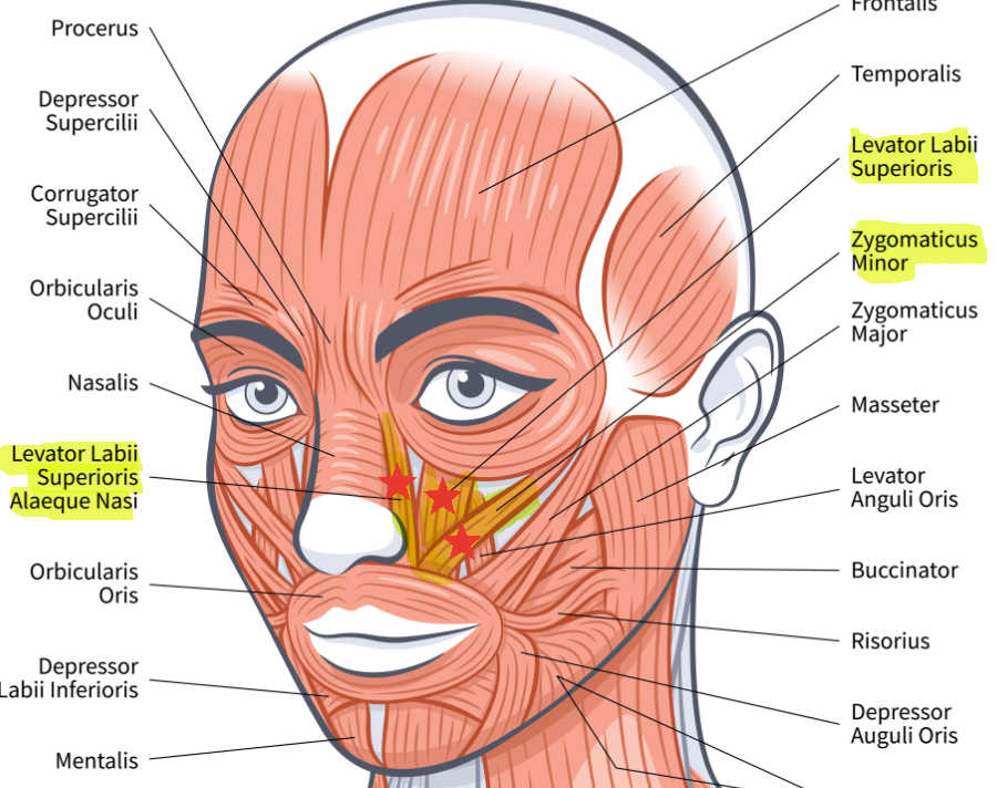 Botox Lip Flip How Many Units What To Know Before Getting Injections