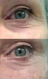 Your Anti-Aging Resource Forum – Share Your Best Beauty Secrets